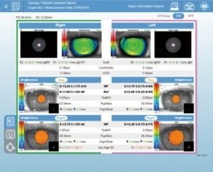 Refractive Power / Corneal Analyzer OPD-Scan III vs – אבנט מדיקל